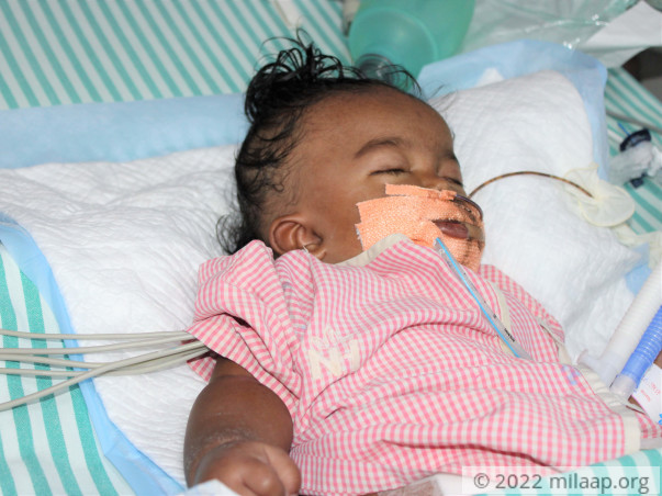 9-months old baby of Suma needs your help for his treatment