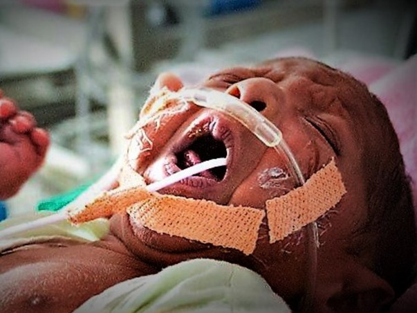 Help 15 Days old Baby Undergo Bone Marrow Transplant