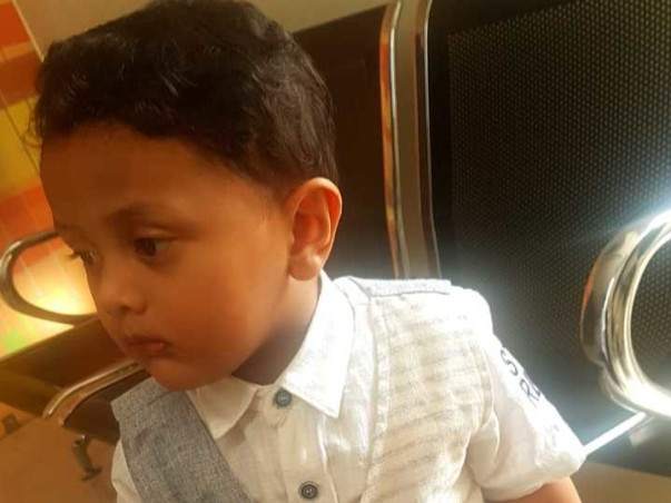 2 Years Old Safwan Ali Needs Your Help Undergo Surgery