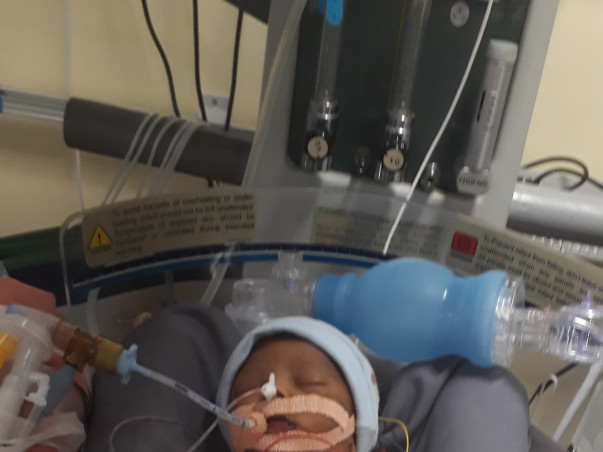 Support Euriel Raoul Rodricks To Recover From Preterm Birth