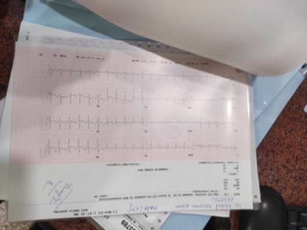 Urgent Appeal For Abdul Waseem Khan's Critical Medical Expenses!