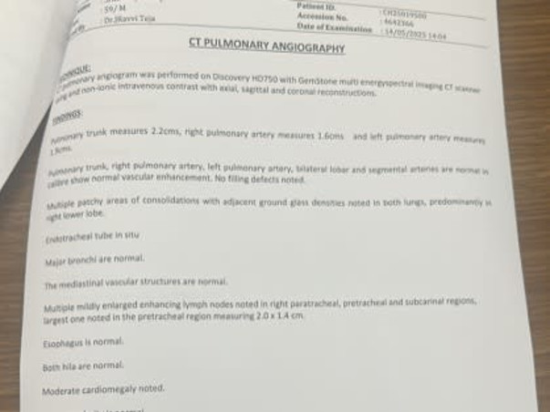 Support P Srinivas Reddy fight/recover from Brain Stroke